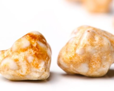 Gallstones | Khetarpal Hospital